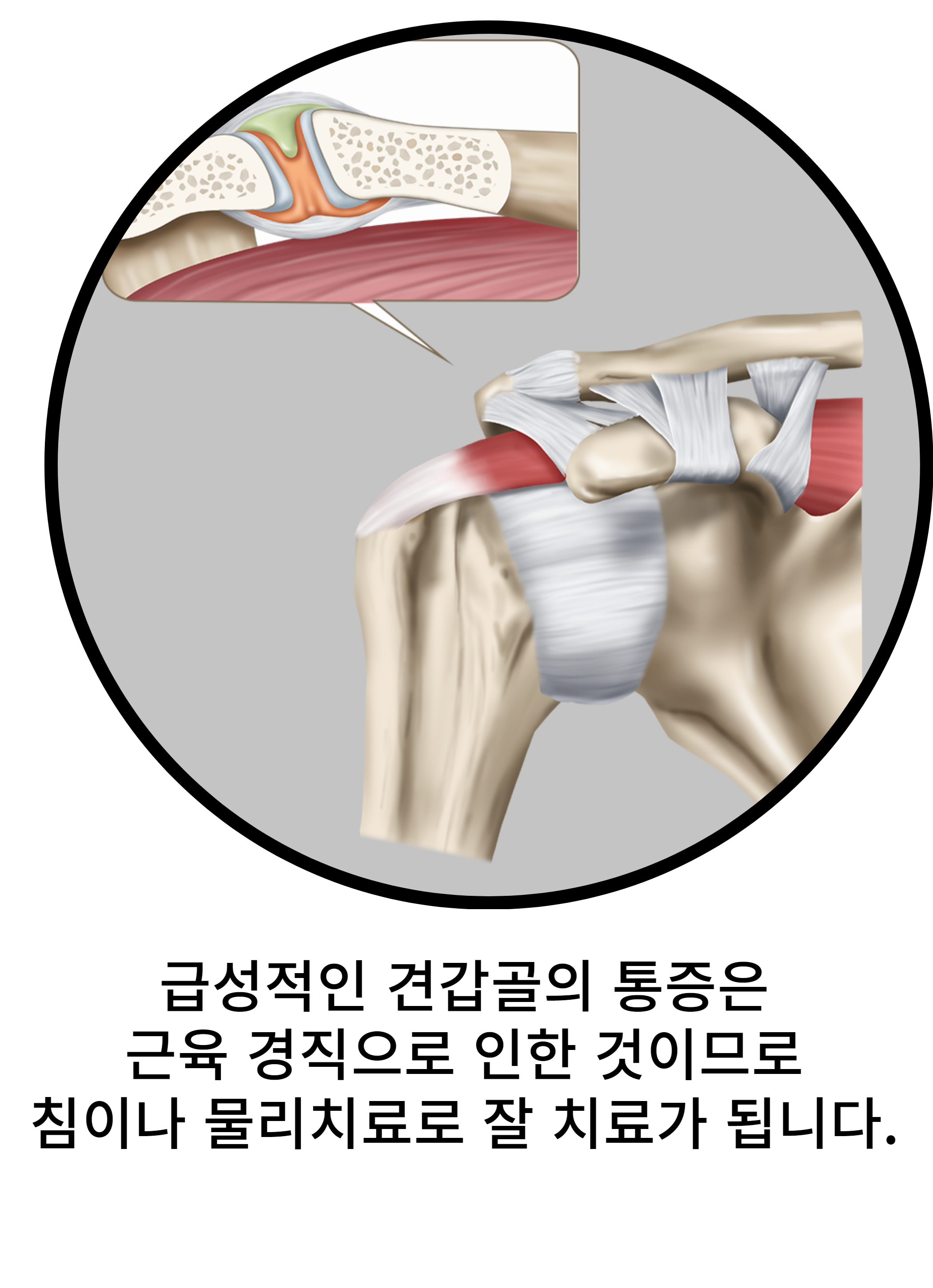 날개뼈 통증 견갑골 담 결렸을 때 어떻게 하나요 네이버 블로그